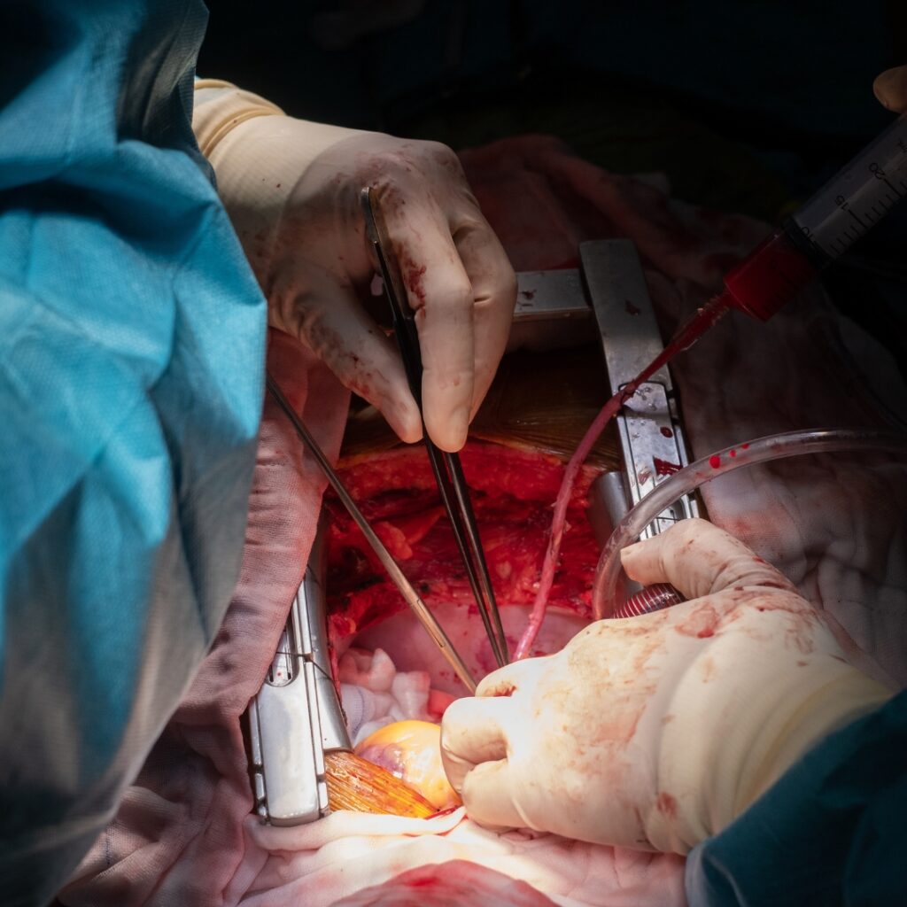 Cardiothoracic Surgery